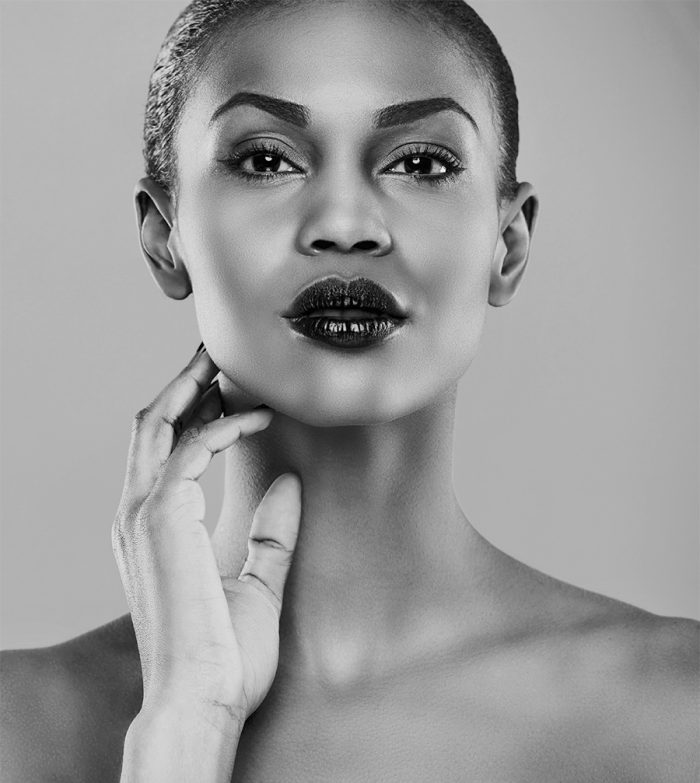 Facelift - Toronto Dermaplastic Clinic